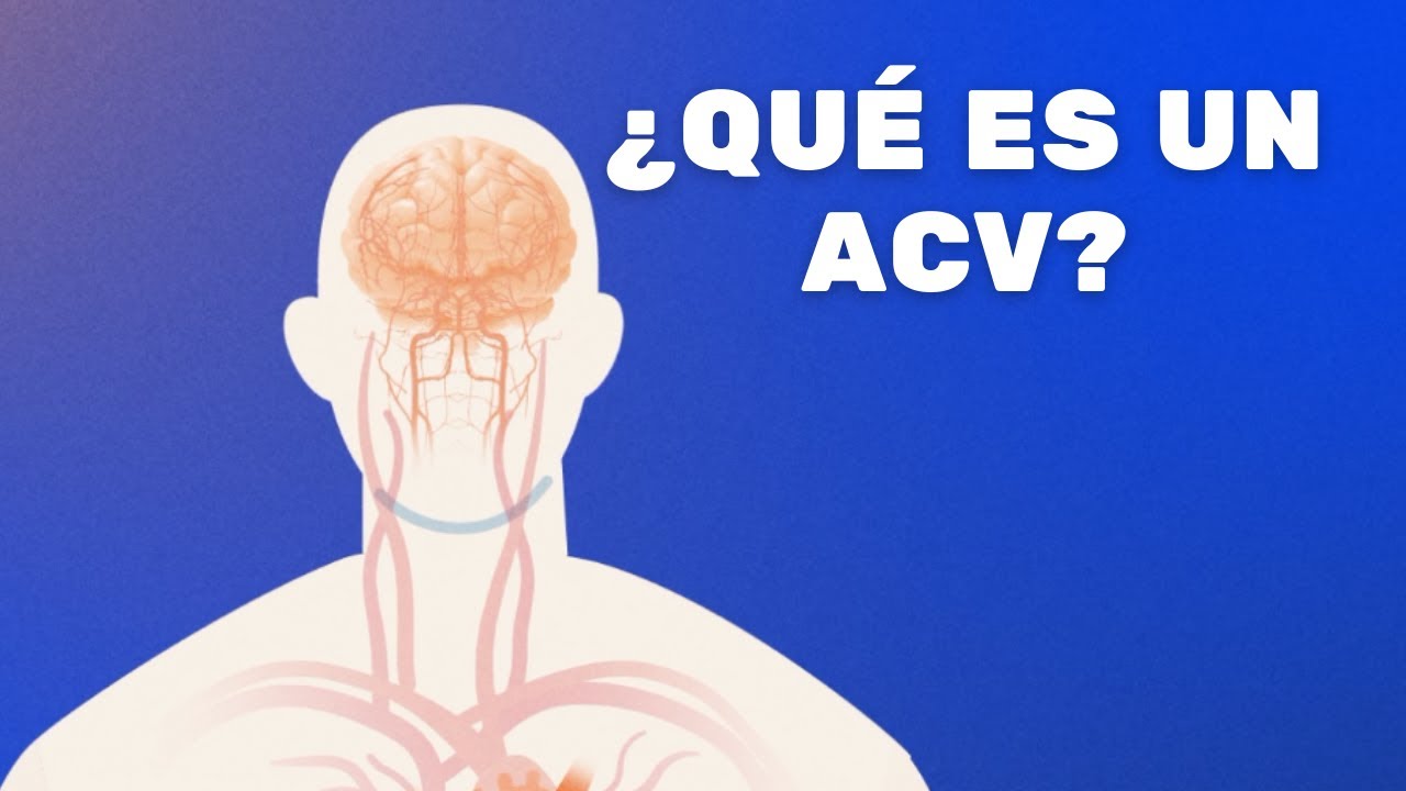 ¿Qué es un ACV y cómo se produce? Todo lo que necesitas saber sobre el accidente cerebrovascular ...