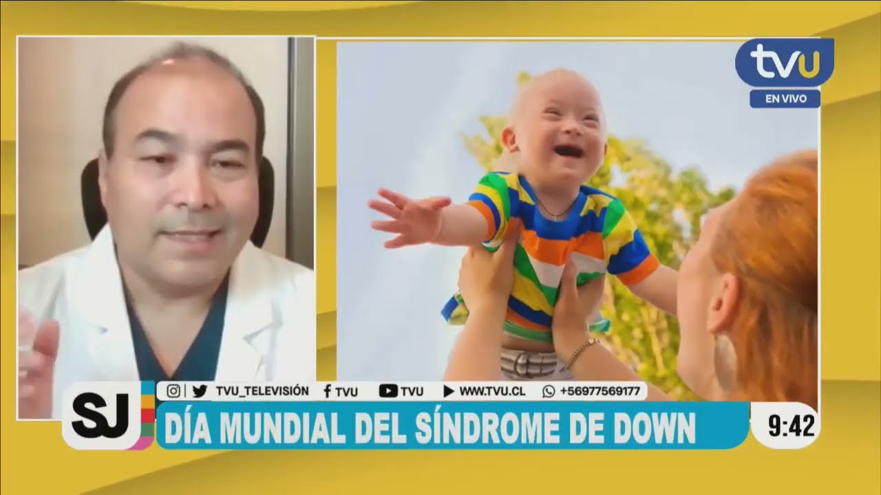 Coeficiente Intelectual de Personas con Síndrome de Down: Lo que Debes Saber - Psicolegis La Web ...